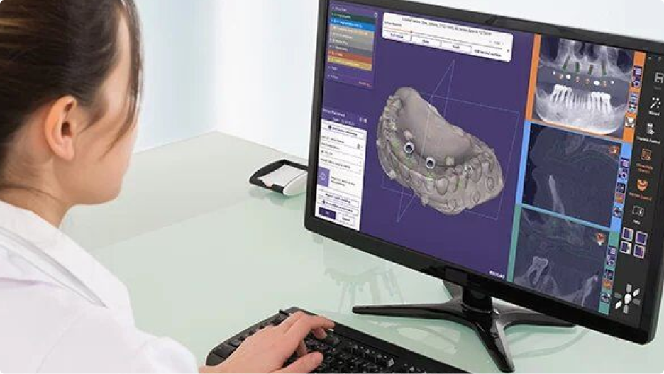 Myray Intraoral And Extraoral Dental Radiography Equipment